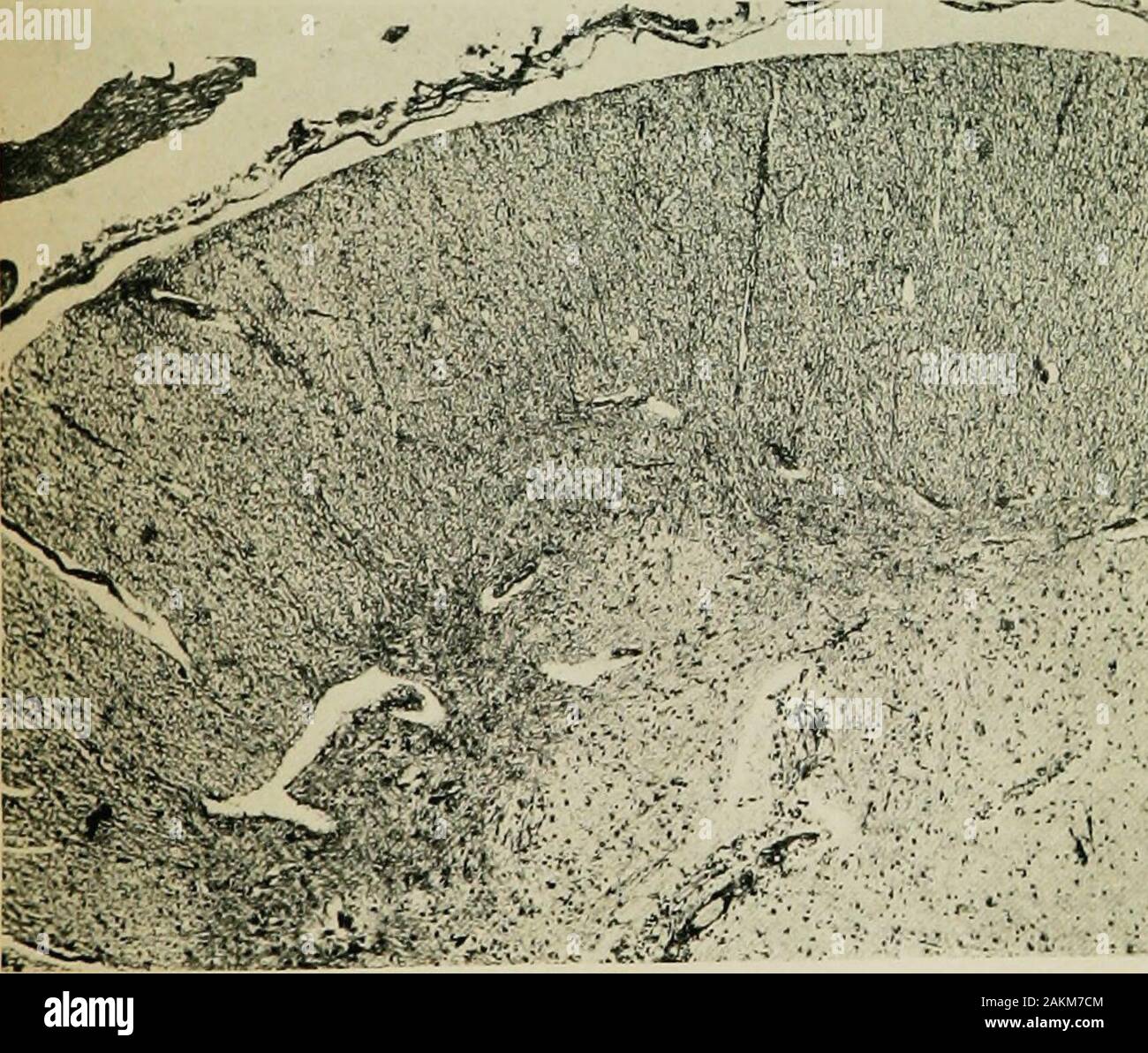 Scurvy past and present . sus i SH? it Fig. 3.—High power. Section of ...