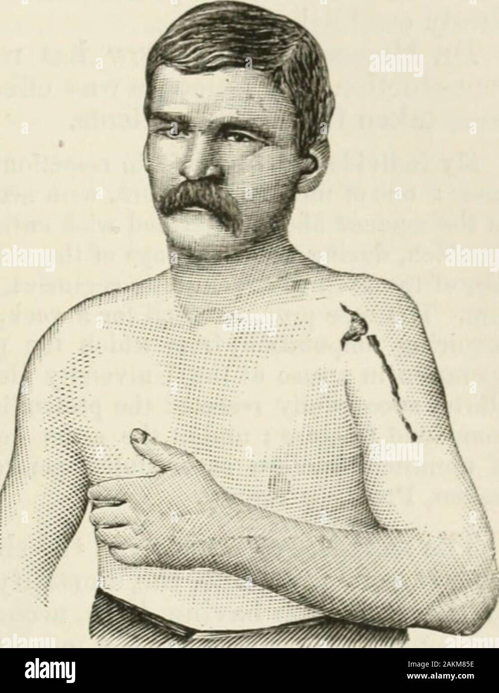 Musculo longitudinal hi-res stock photography and images - Alamy