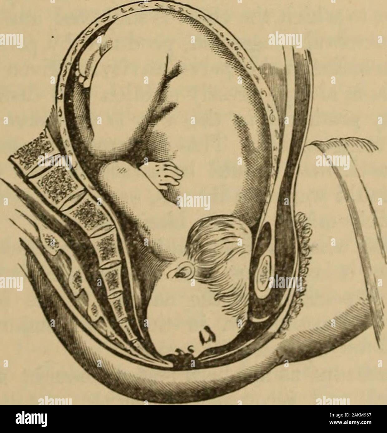 Occiput posterior hi-res stock photography and images - Alamy