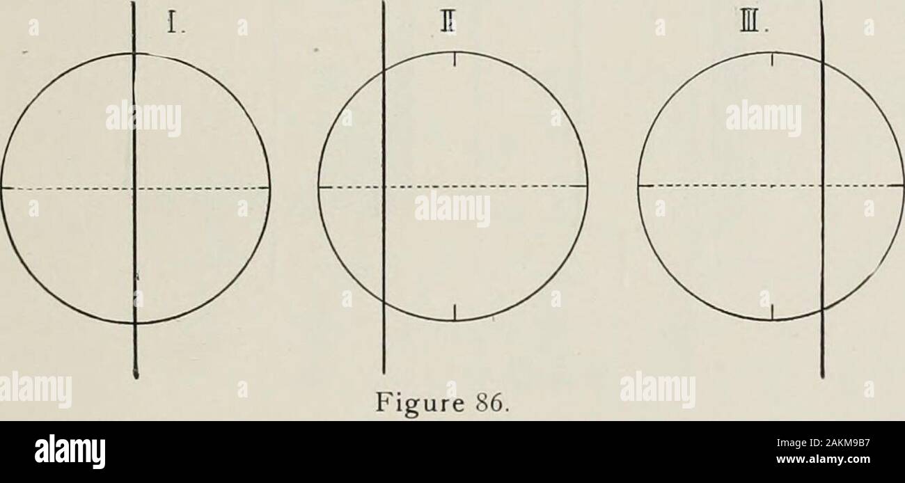 Ocular refraction and the shadow test . d II, figure 85 illustrates the ...