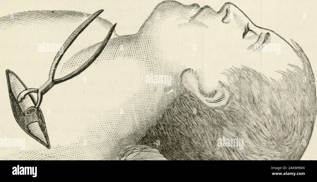1823 surgery hi-res stock photography and images - Alamy