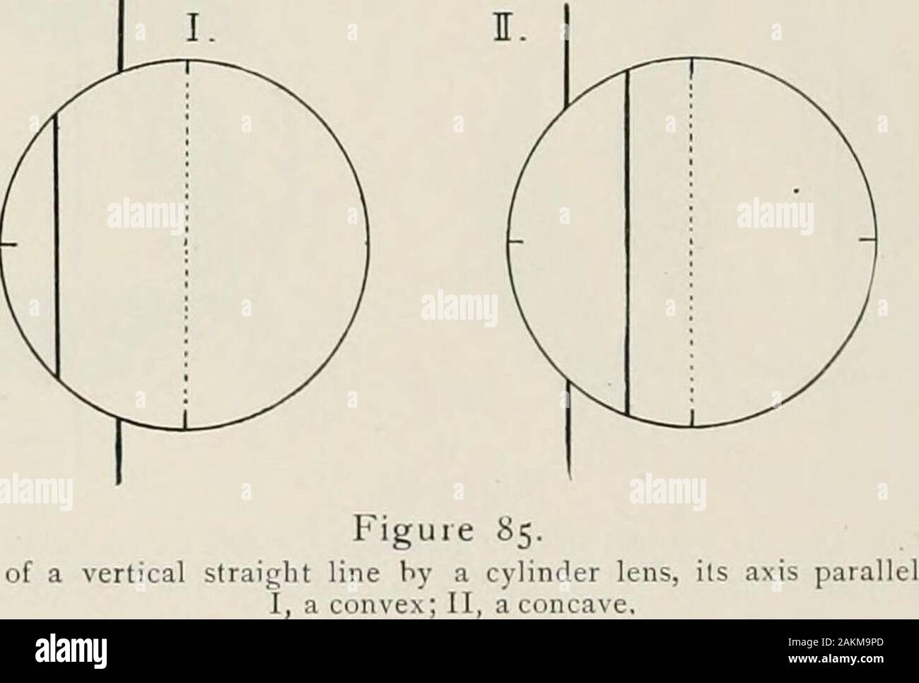 Ocular refraction and the shadow test . a double purpose, by means of ...