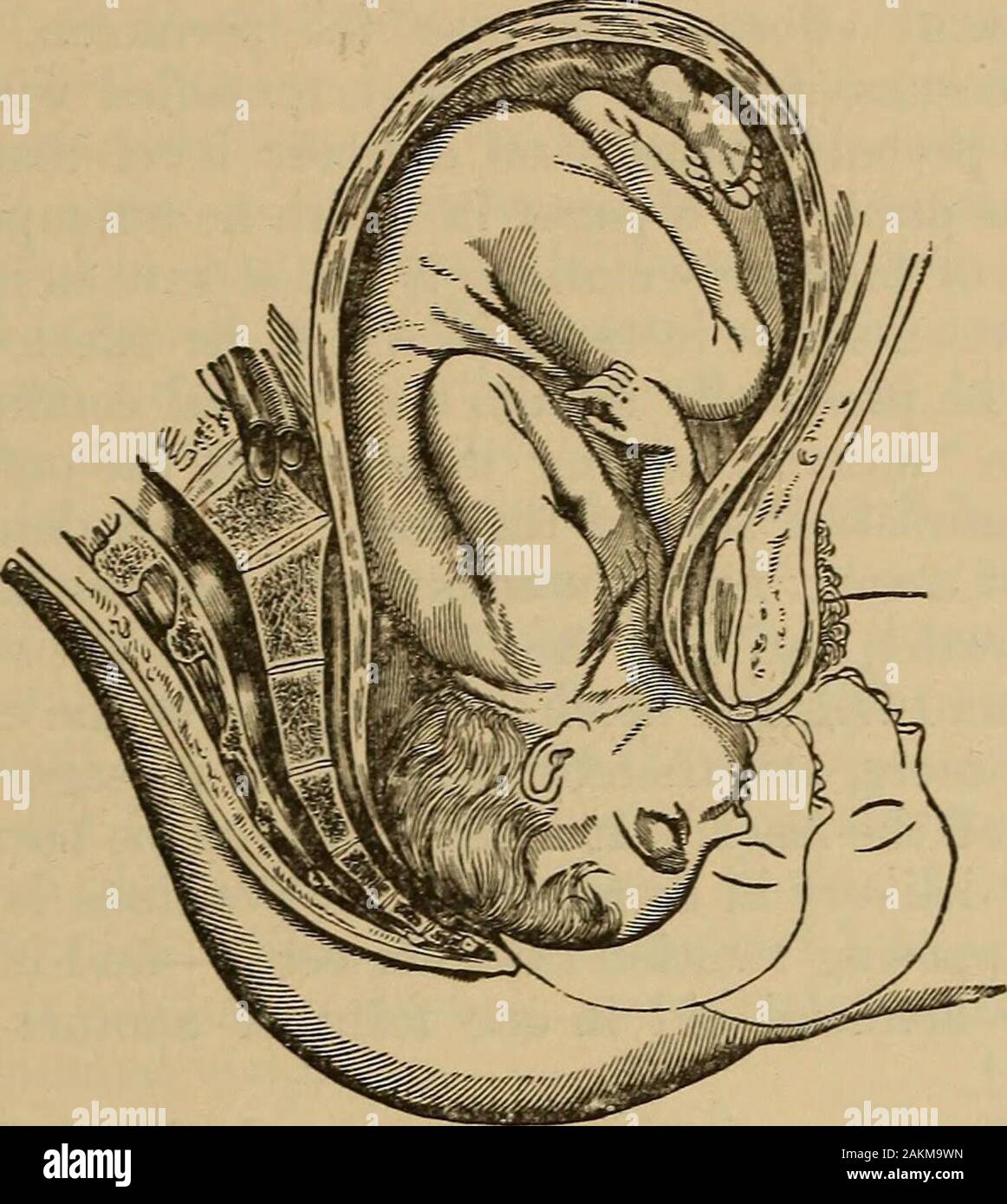 A treatise on the science and practice of midwifery . Rotation Forward ...