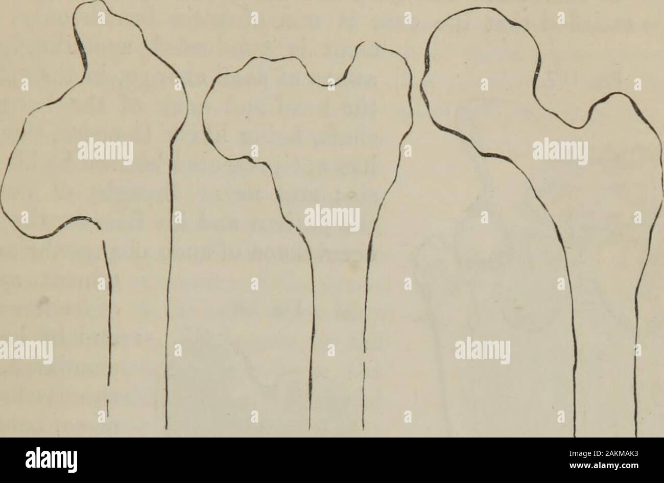 Senile decay hi-res stock photography and images - Alamy