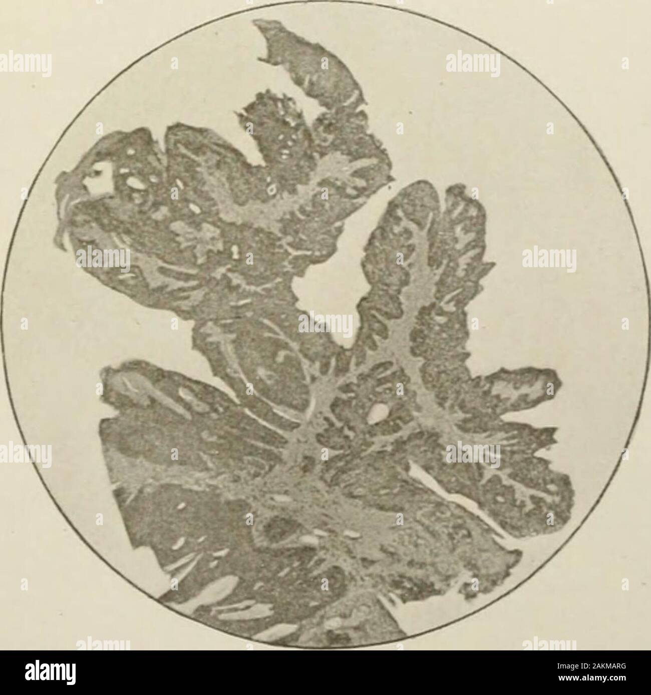 General and dental pathology with special reference to etiology and ...