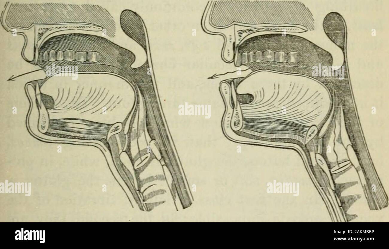 Pre vents noise hi-res stock photography and images - Alamy