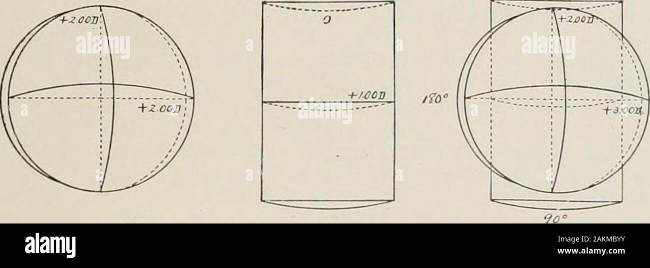 Ocular refraction and the shadow test . he LENSES. 69 reading of the ...