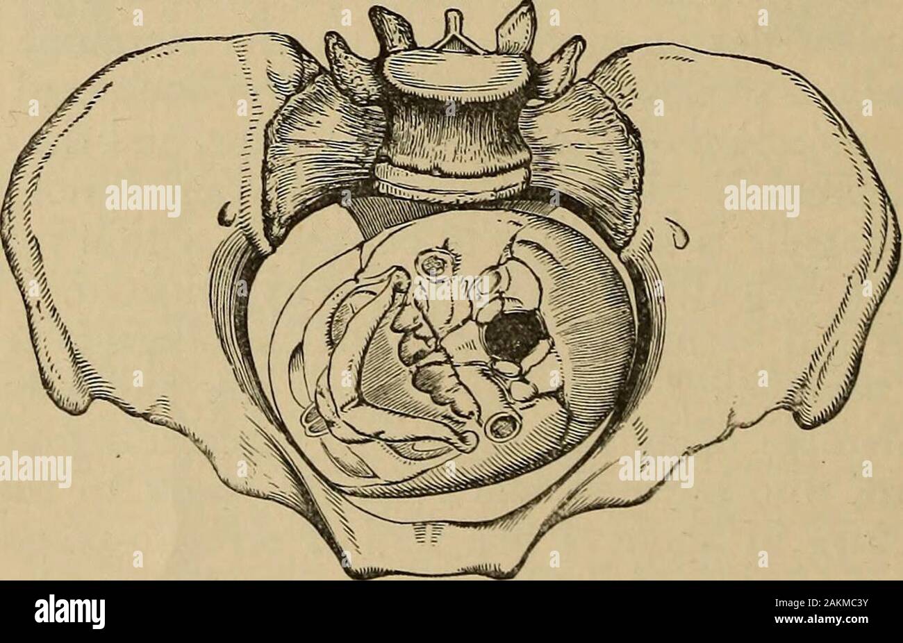 Occiput posterior hi-res stock photography and images - Alamy