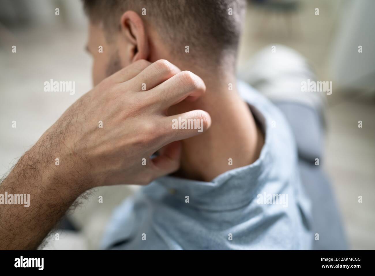 Close-up Of A Man's Hand Scratching Itch On His Neck Stock Photo - Alamy