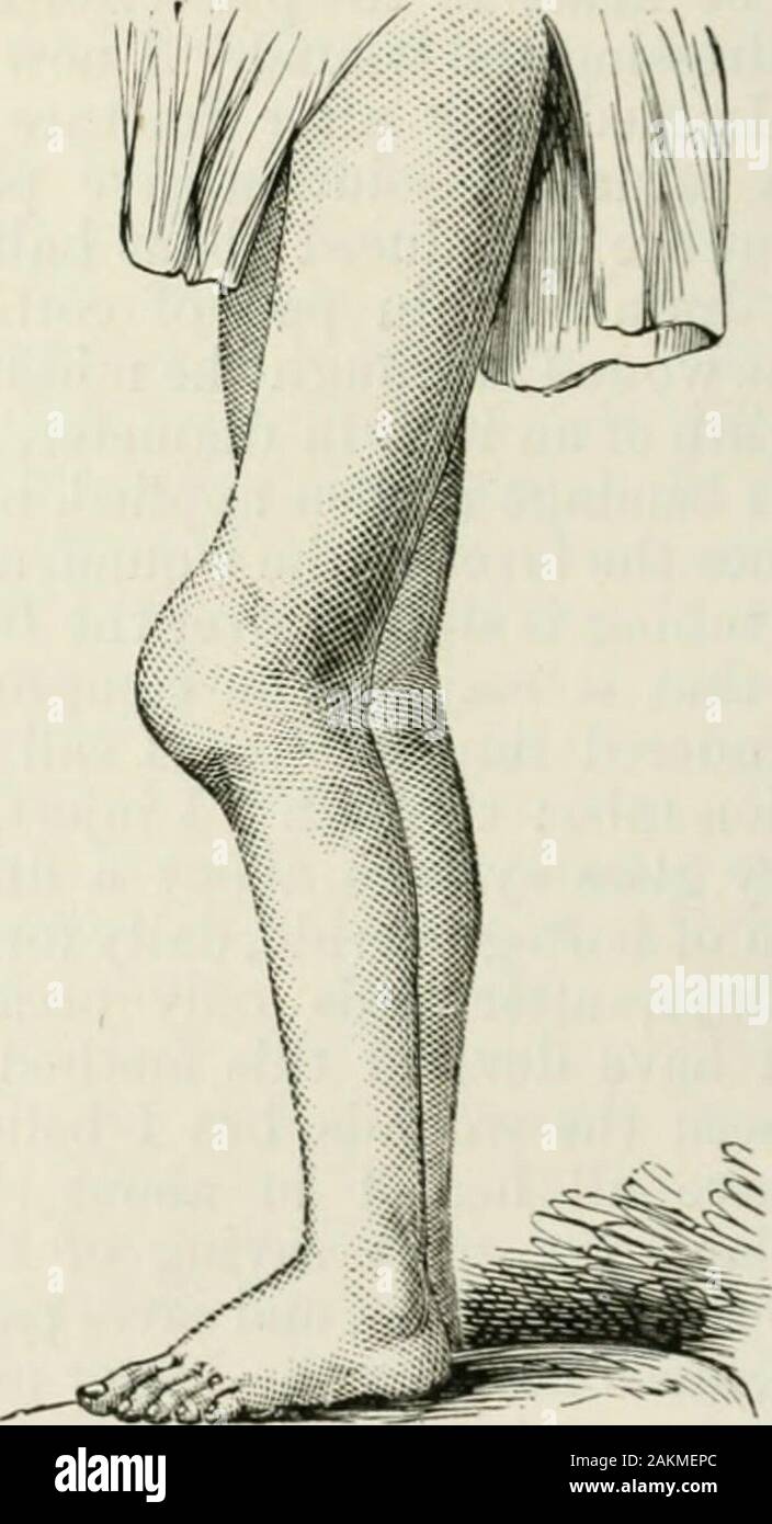 The international encyclopaedia of surgery; a systematic treatise on ...