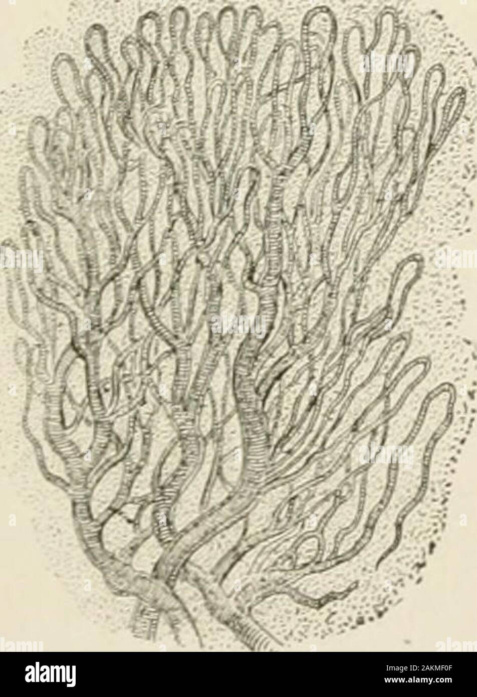 Swollen blood cells hi-res stock photography and images - Alamy