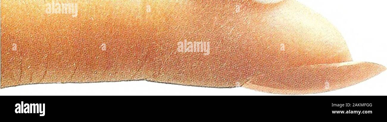 Gaviscon for children hi-res stock photography and images - Alamy