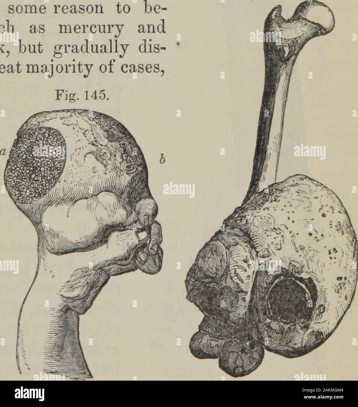 2 small ribs hi-res stock photography and images - Alamy