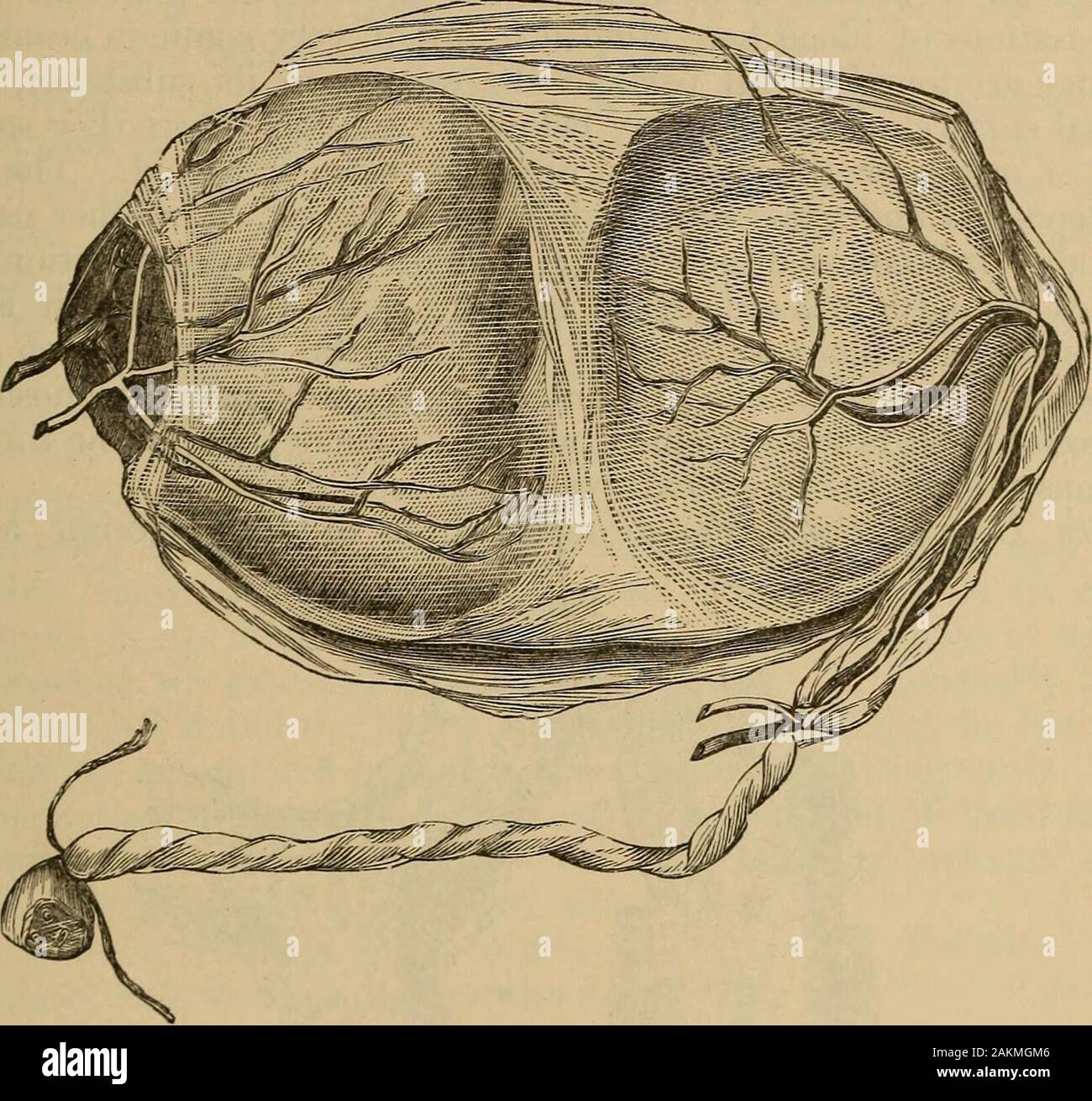 Double uterus hi-res stock photography and images - Alamy