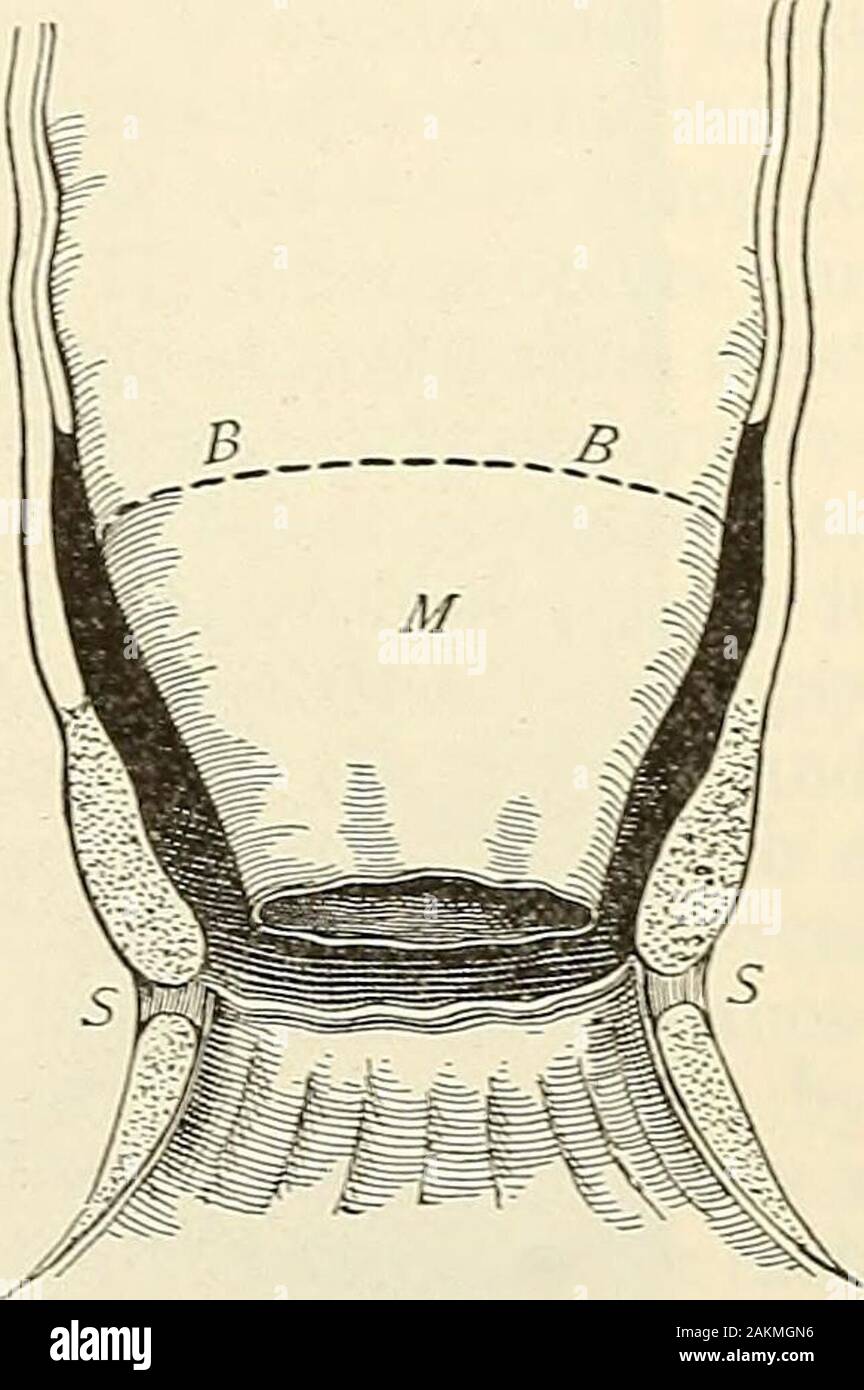 Modern surgery, general and operative . d by more pain, healing ...