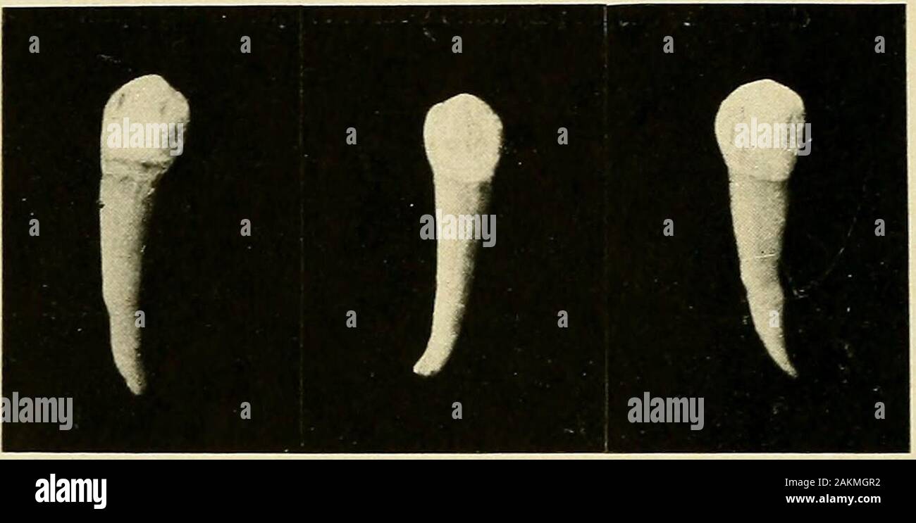 Principles and practice of operative dentistry . Fig. 554.—Superior ...