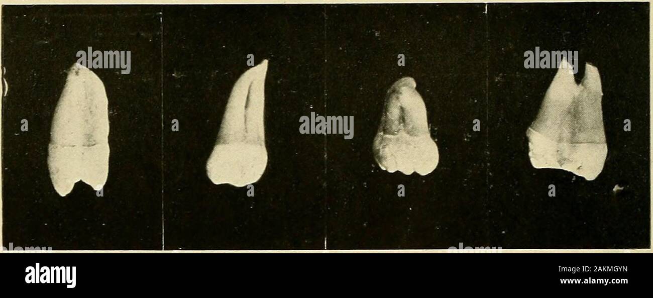 Principles and practice of operative dentistry . Fig. 553.—Superior ...