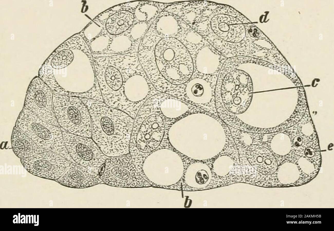 Smallpox cases hi-res stock photography and images - Alamy