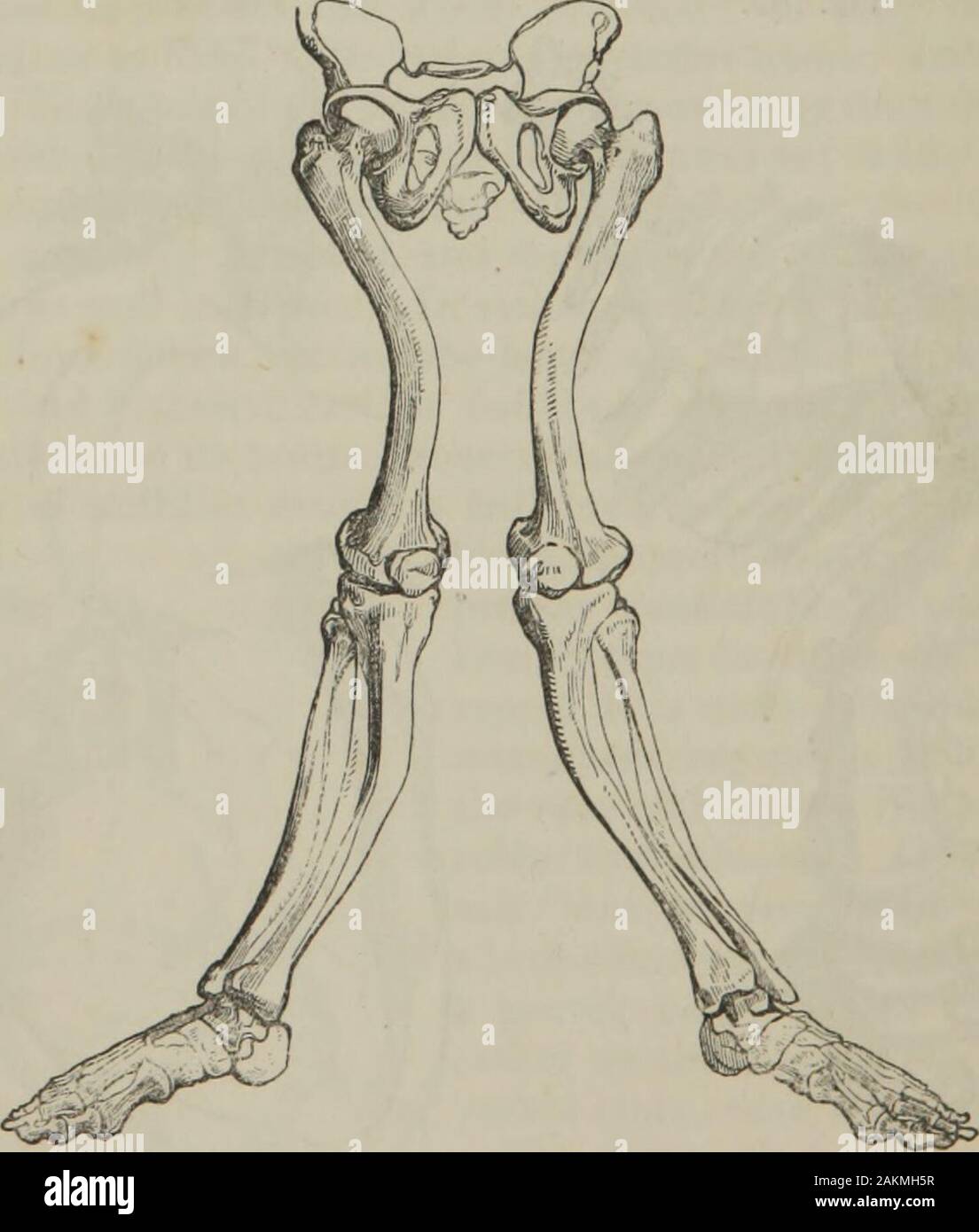 Bone thickness hi-res stock photography and images - Alamy