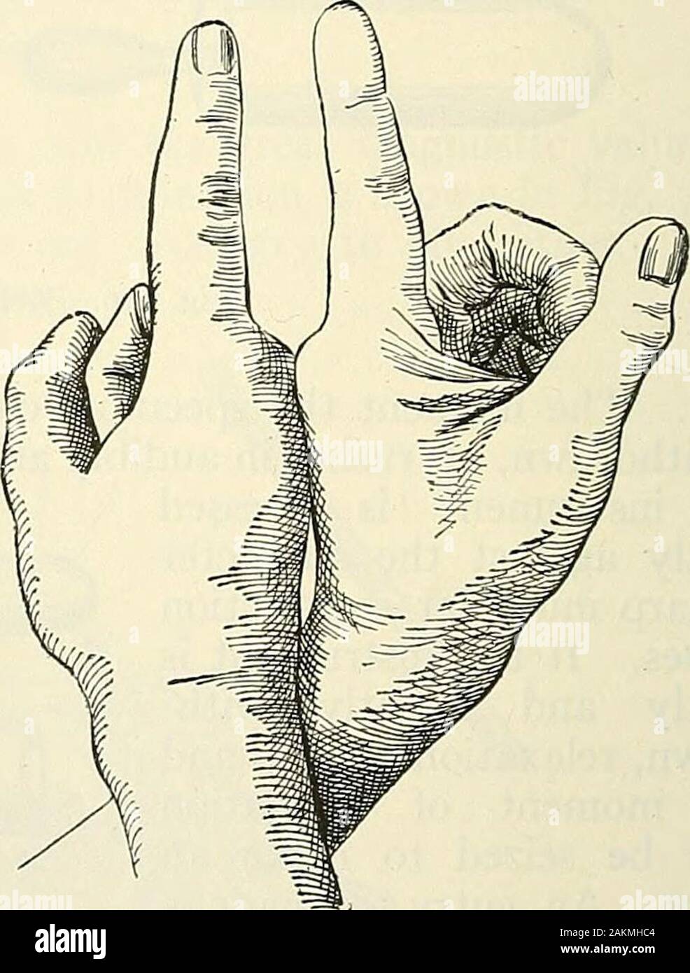 Proctoscopy hi-res stock photography and images - Alamy