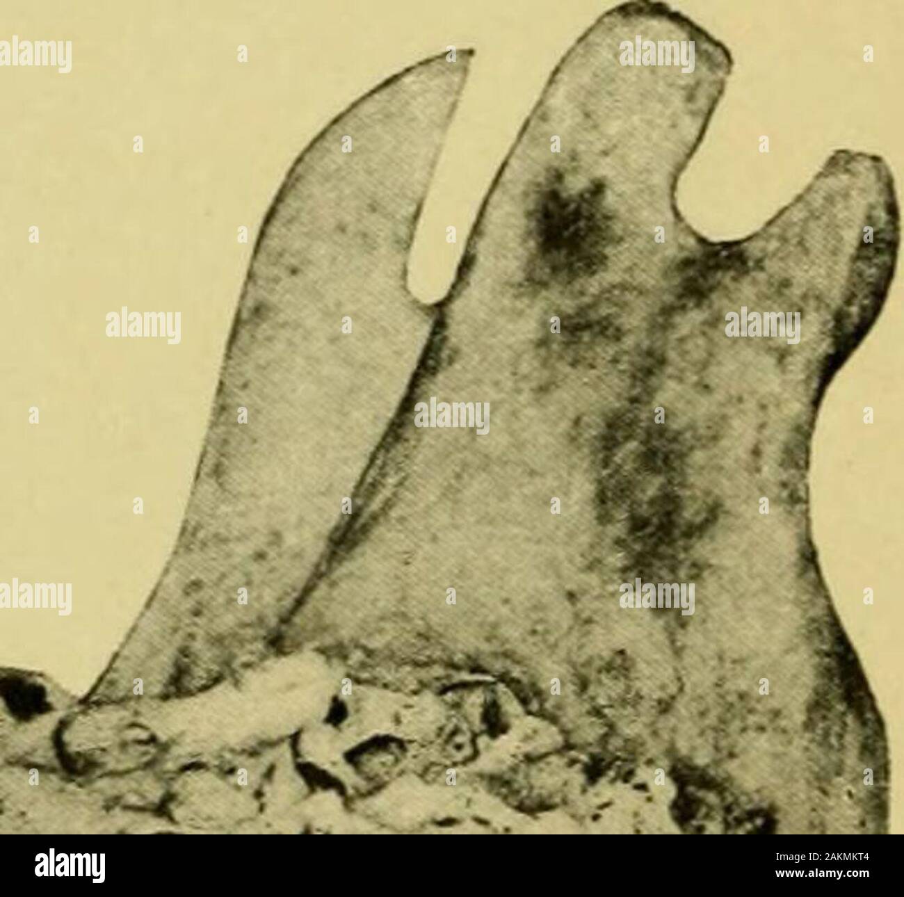 Lumpy jaw disease hi-res stock photography and images - Alamy