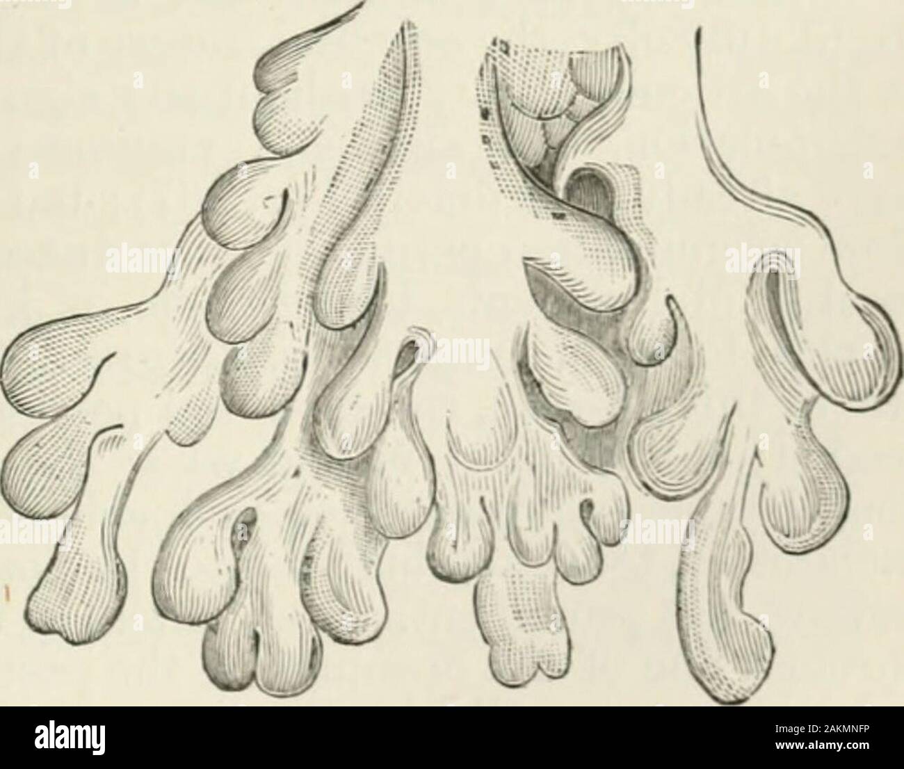 Hydrarthrosis hi-res stock photography and images - Alamy