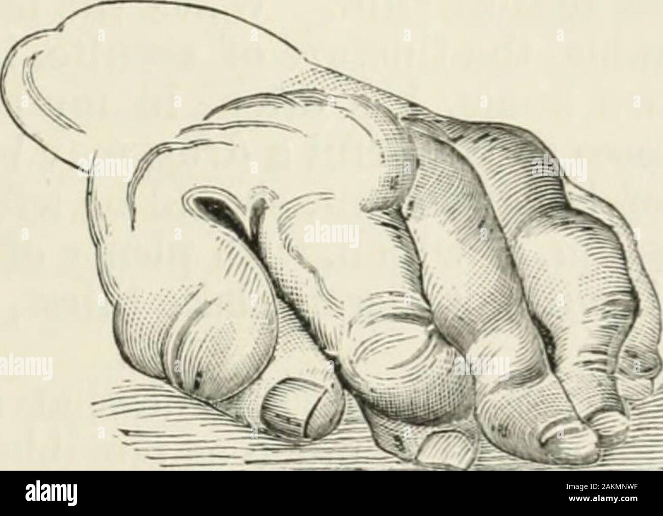 Asthenic hi-res stock photography and images - Alamy