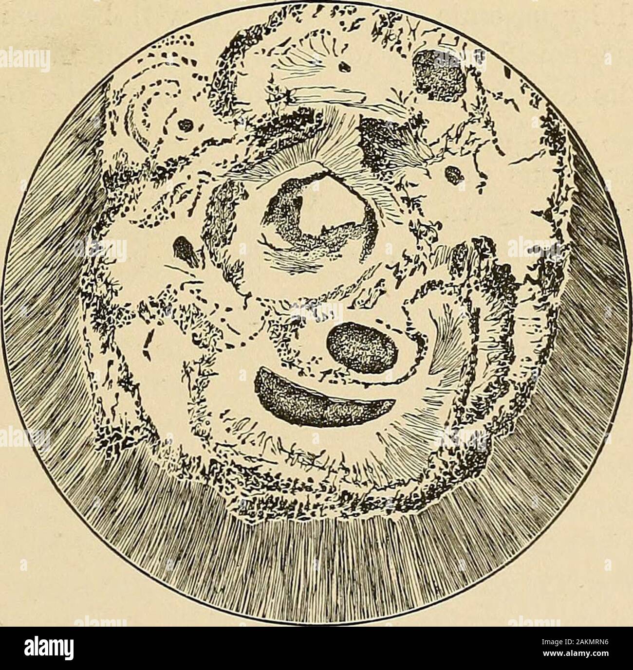 Resorbed hi-res stock photography and images - Alamy