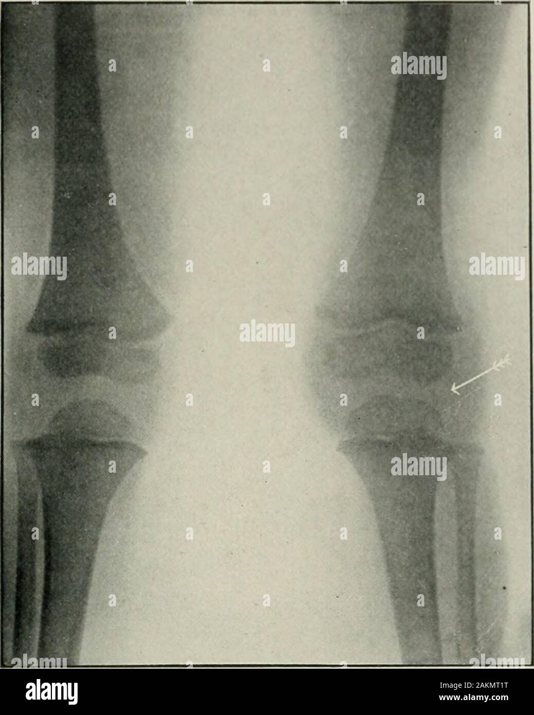 American practice of surgery : a complete system of the science and art ...
