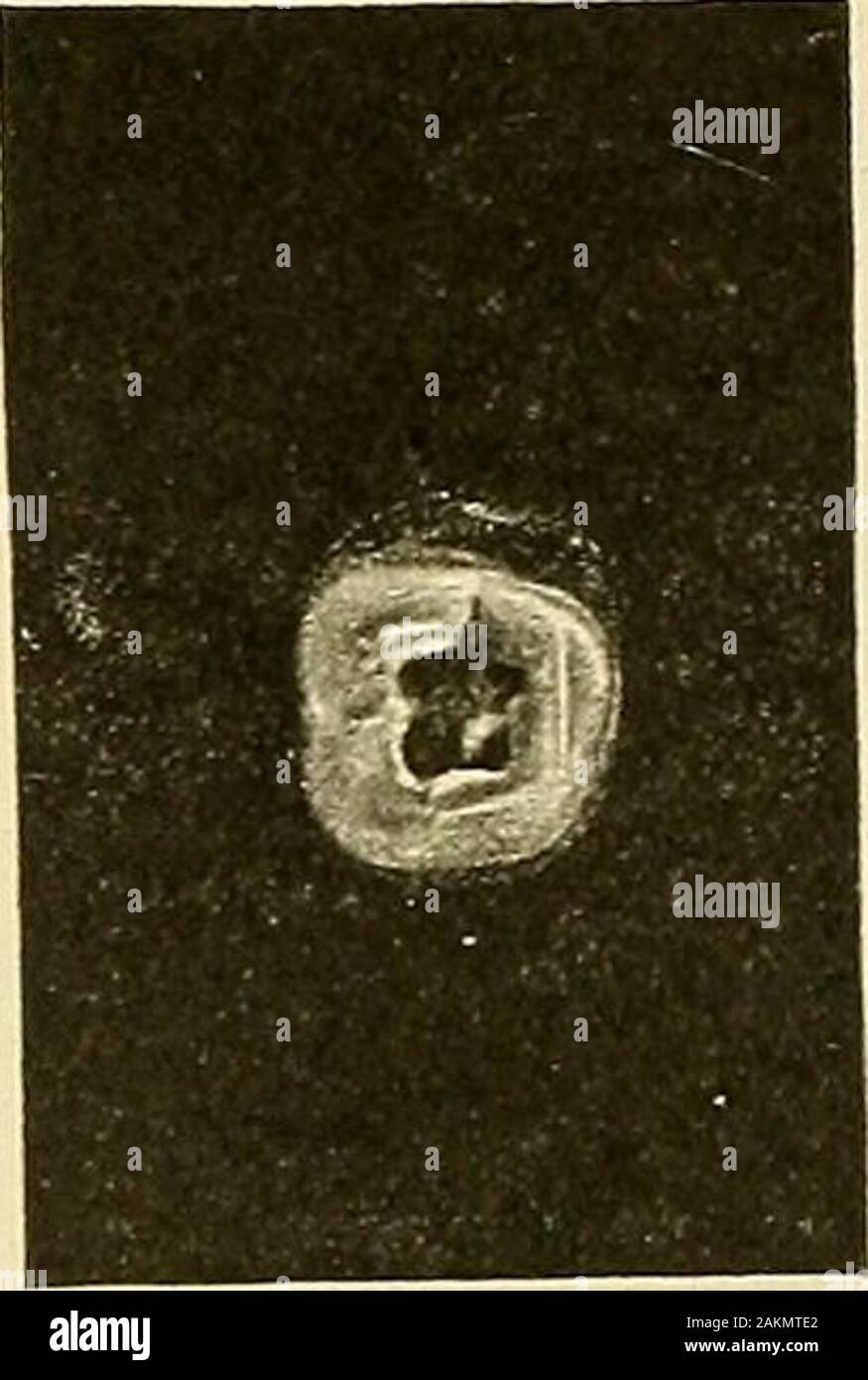 Principles and practice of operative dentistry . Cylindrical ...