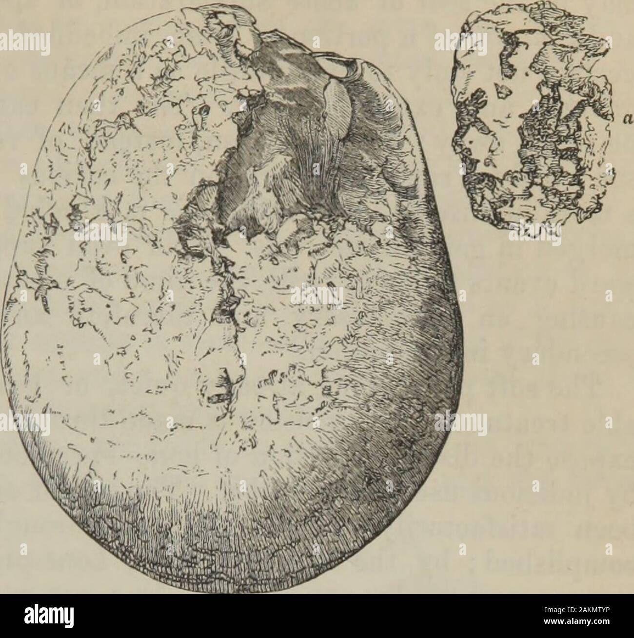 Tubercular ulcer hi-res stock photography and images - Alamy