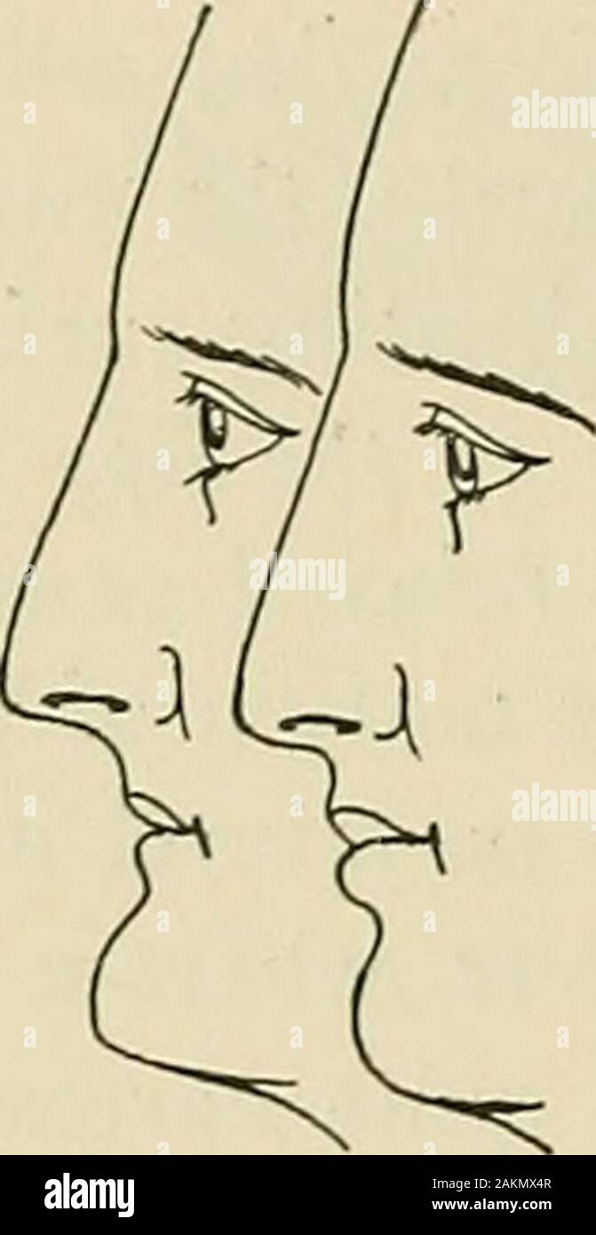 Sunken features hi-res stock photography and images - Alamy