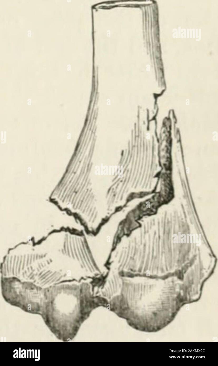 Separated ion hi-res stock photography and images - Alamy