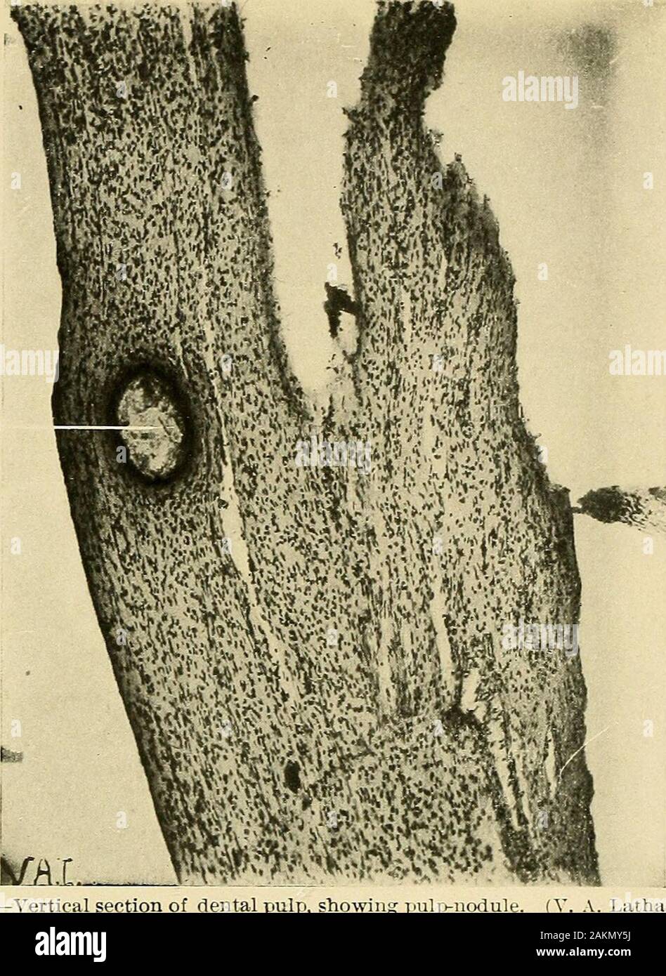 Fig 491 hi-res stock photography and images - Alamy