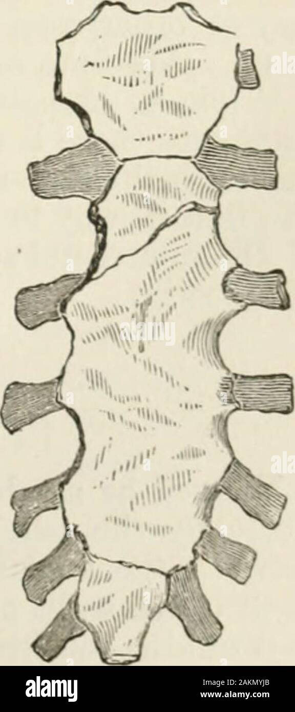 Sternum fracture hi-res stock photography and images - Alamy