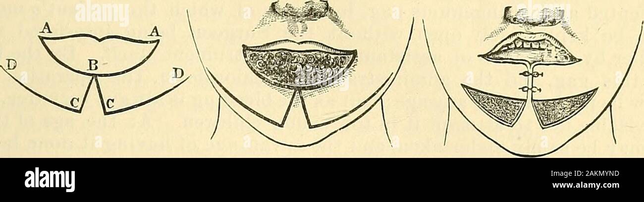 The science and art of surgery : being a treatise on surgical injuries ...