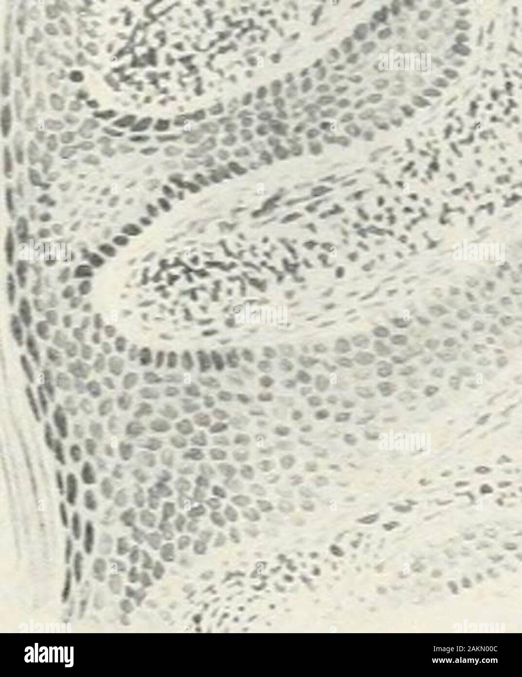 Blepharo conjunctivitis hi-res stock photography and images - Alamy