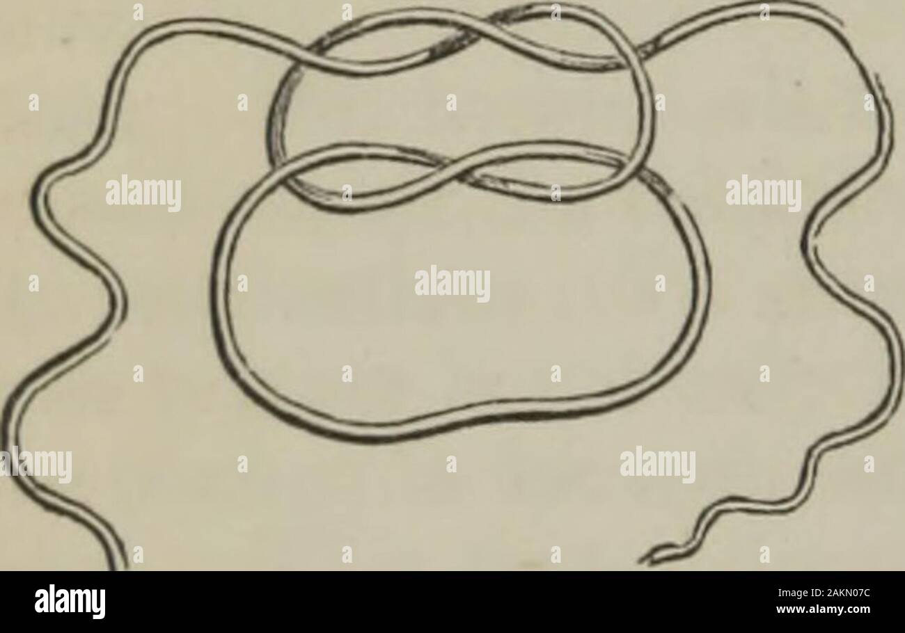 Arterial Bleeding High Resolution Stock Photography and Images - Alamy