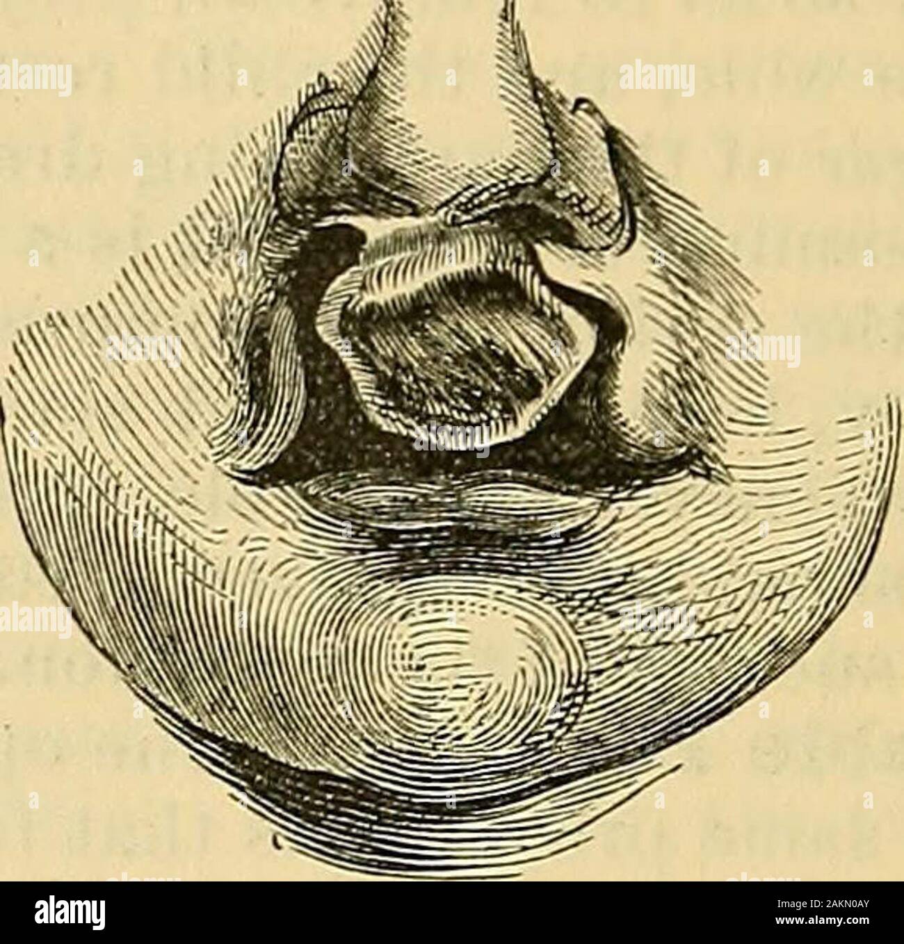 Lateral traction hi-res stock photography and images - Alamy