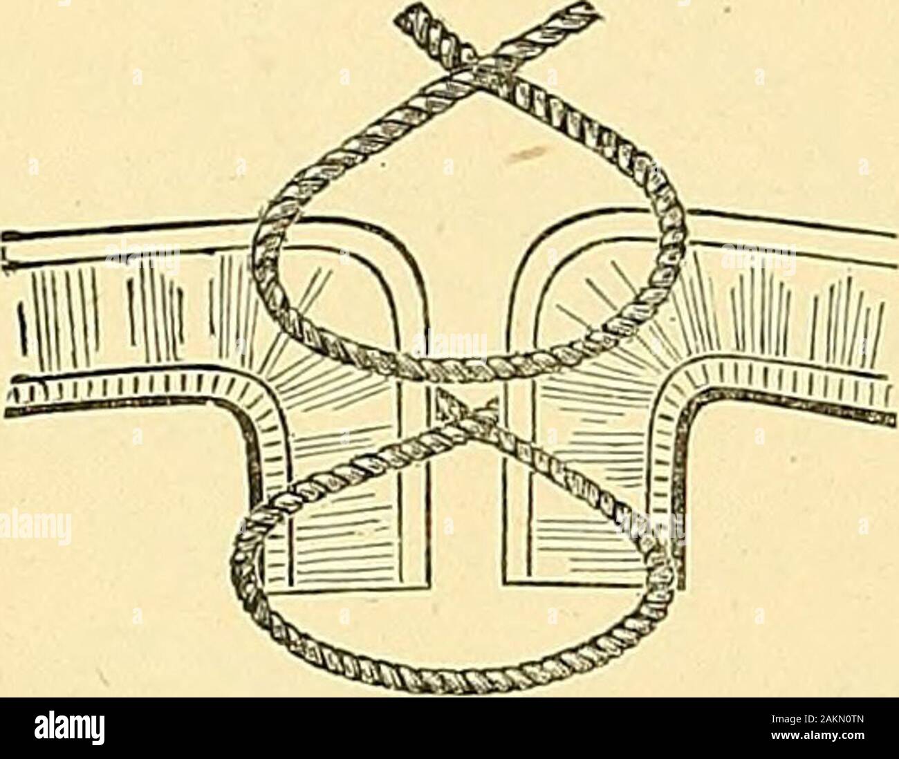 Abdominal surgery . Fig. 62. Lemberts IntestinalSuture.. Fig. 63 ...