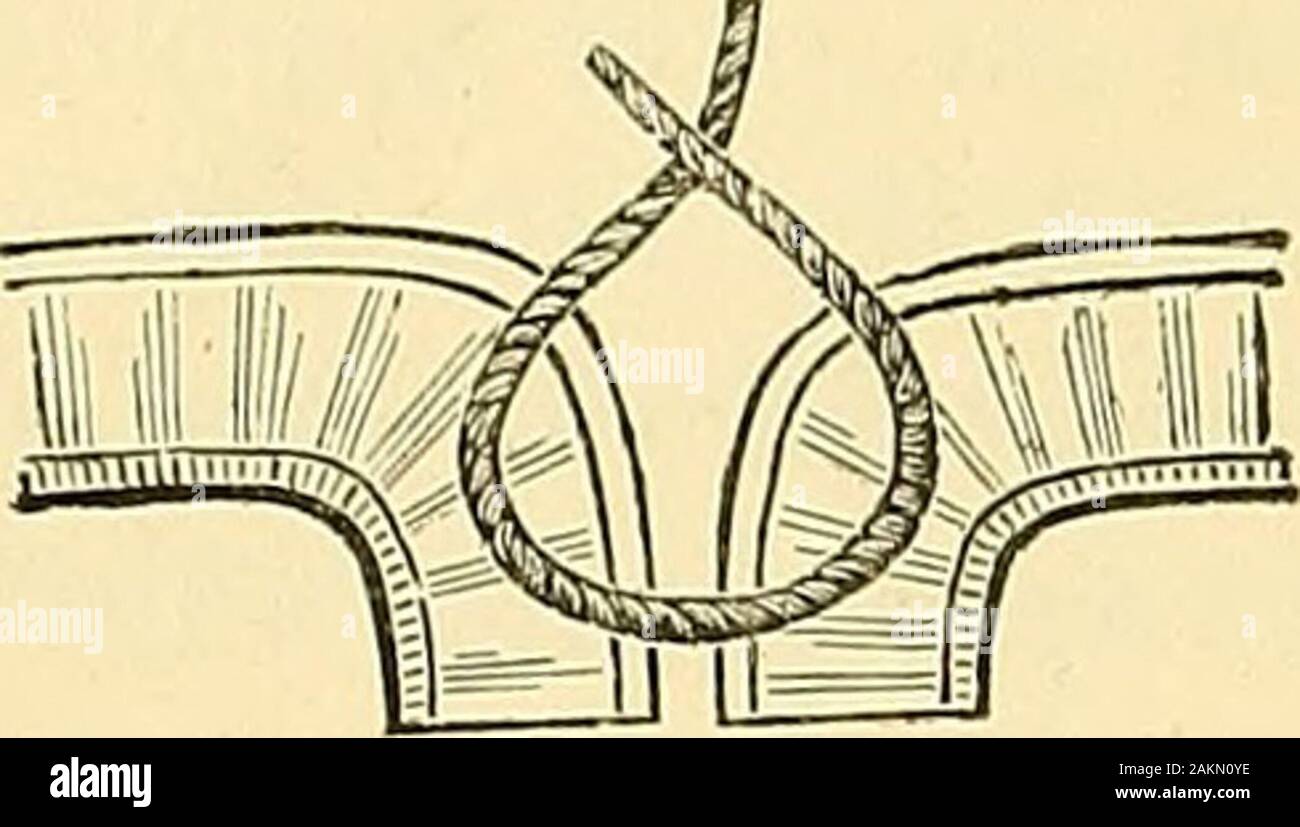 Abdominal surgery . 8 7 Fig. 6i. The Intestinal Suture of Appolito ...