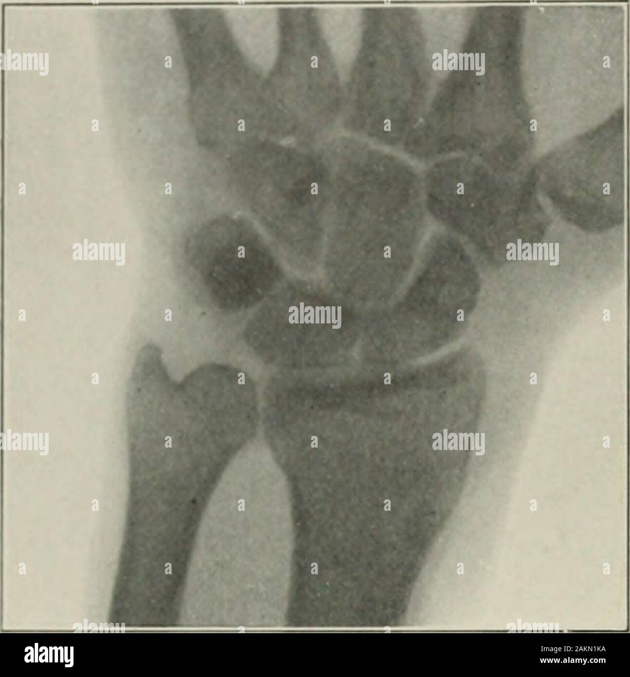 Spark resistance hi-res stock photography and images - Alamy