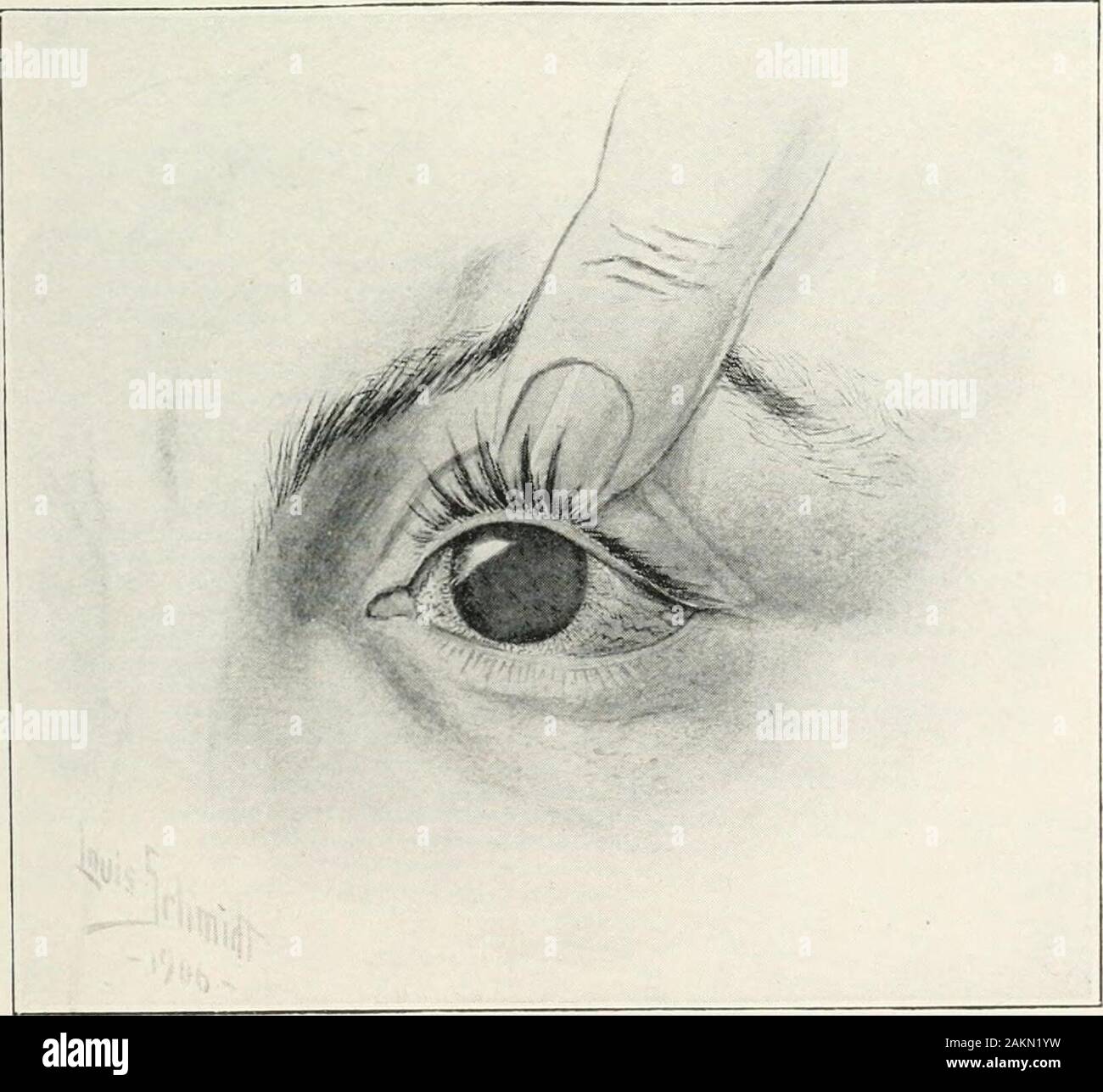 Transactions . Fig. I. — June i, 1905. Fig 2. — Jan. 17, 1906 ...