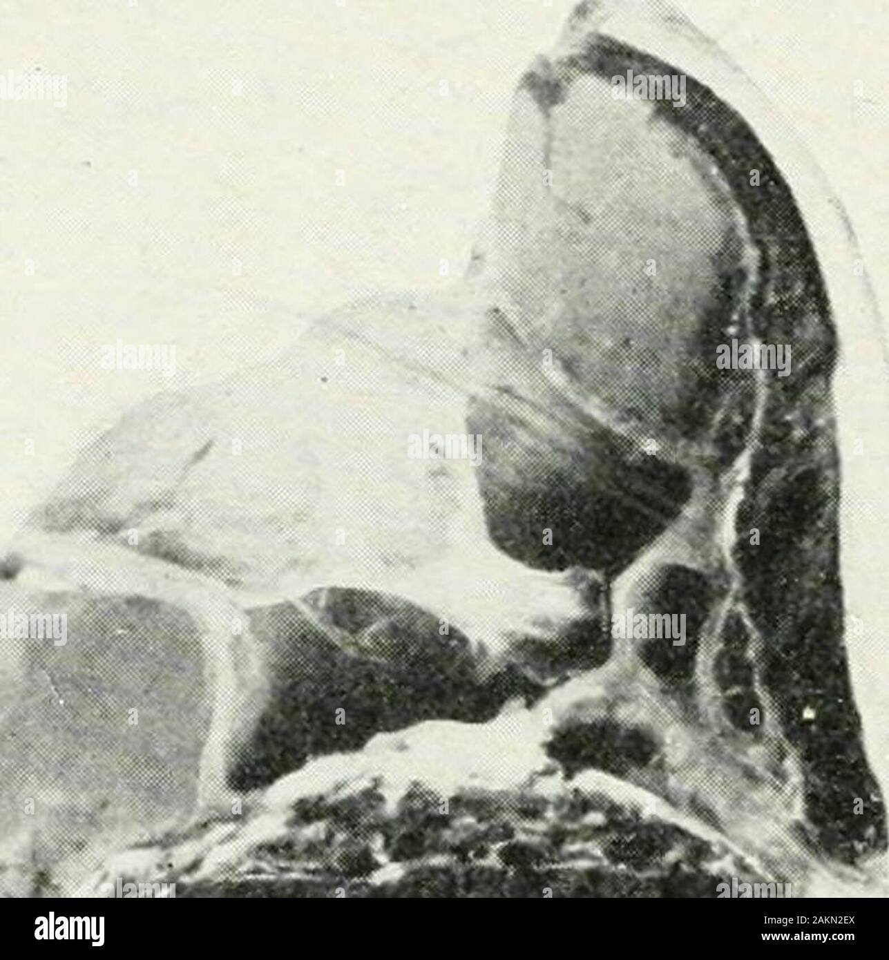 Photopsia hi-res stock photography and images - Alamy