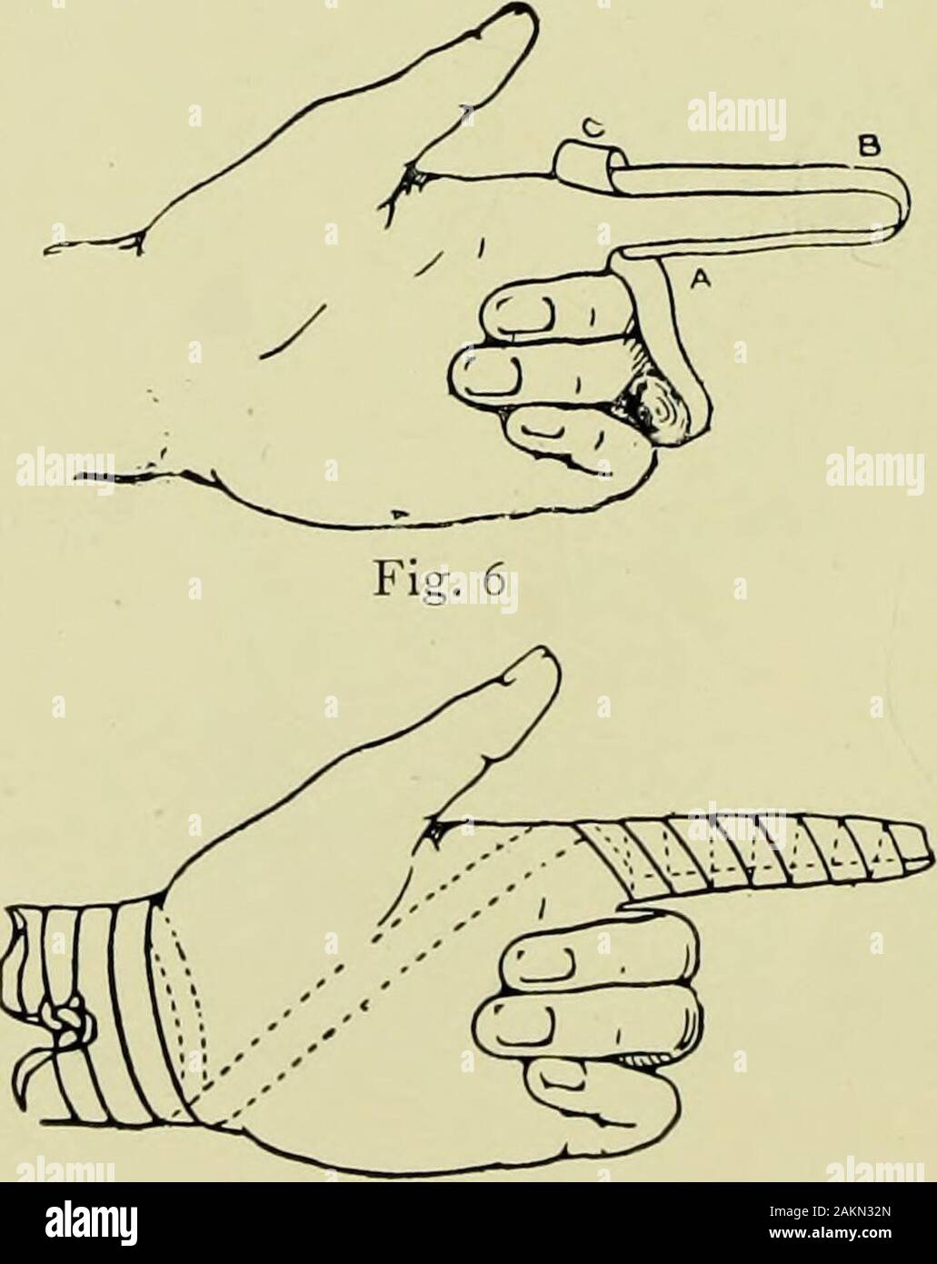 Wound arm water hi-res stock photography and images - Alamy