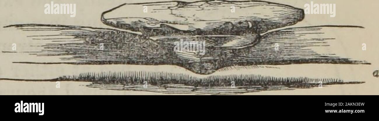 Arterial cone hi-res stock photography and images - Alamy