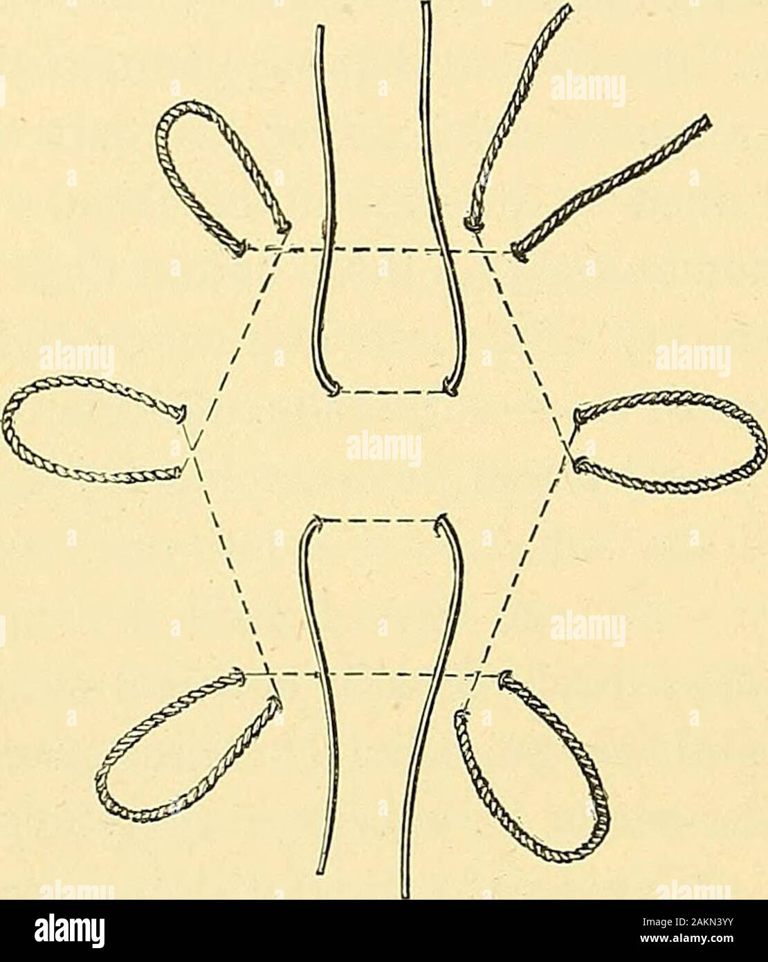 Gastrostomy hi-res stock photography and images - Alamy