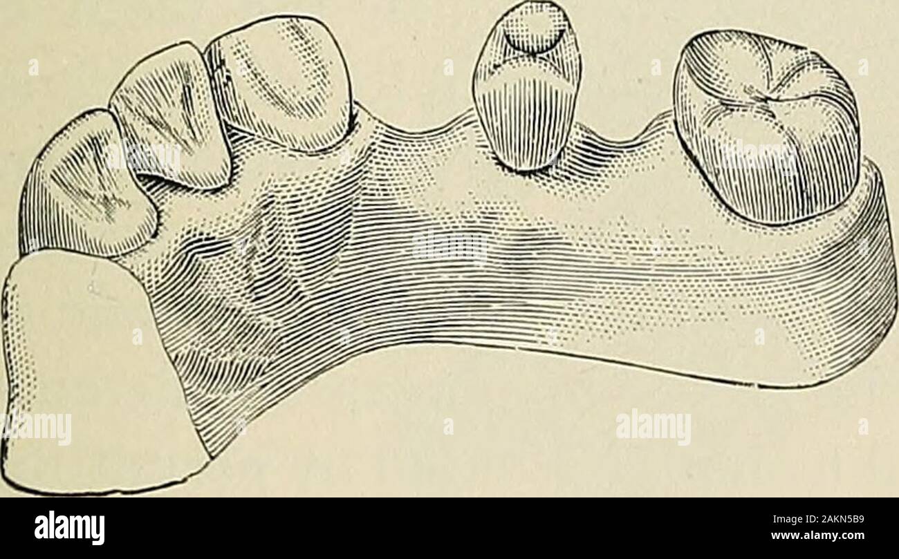 A practical treatise on mechanical dentistry . , miss-ing from its ...