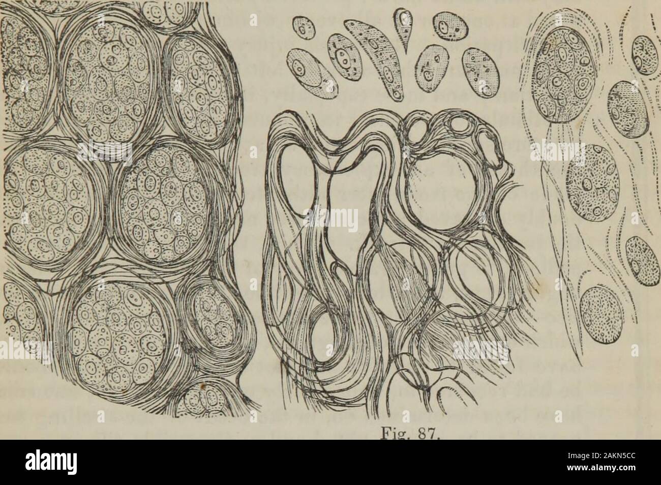 Pre cancerous cells hi-res stock photography and images - Alamy