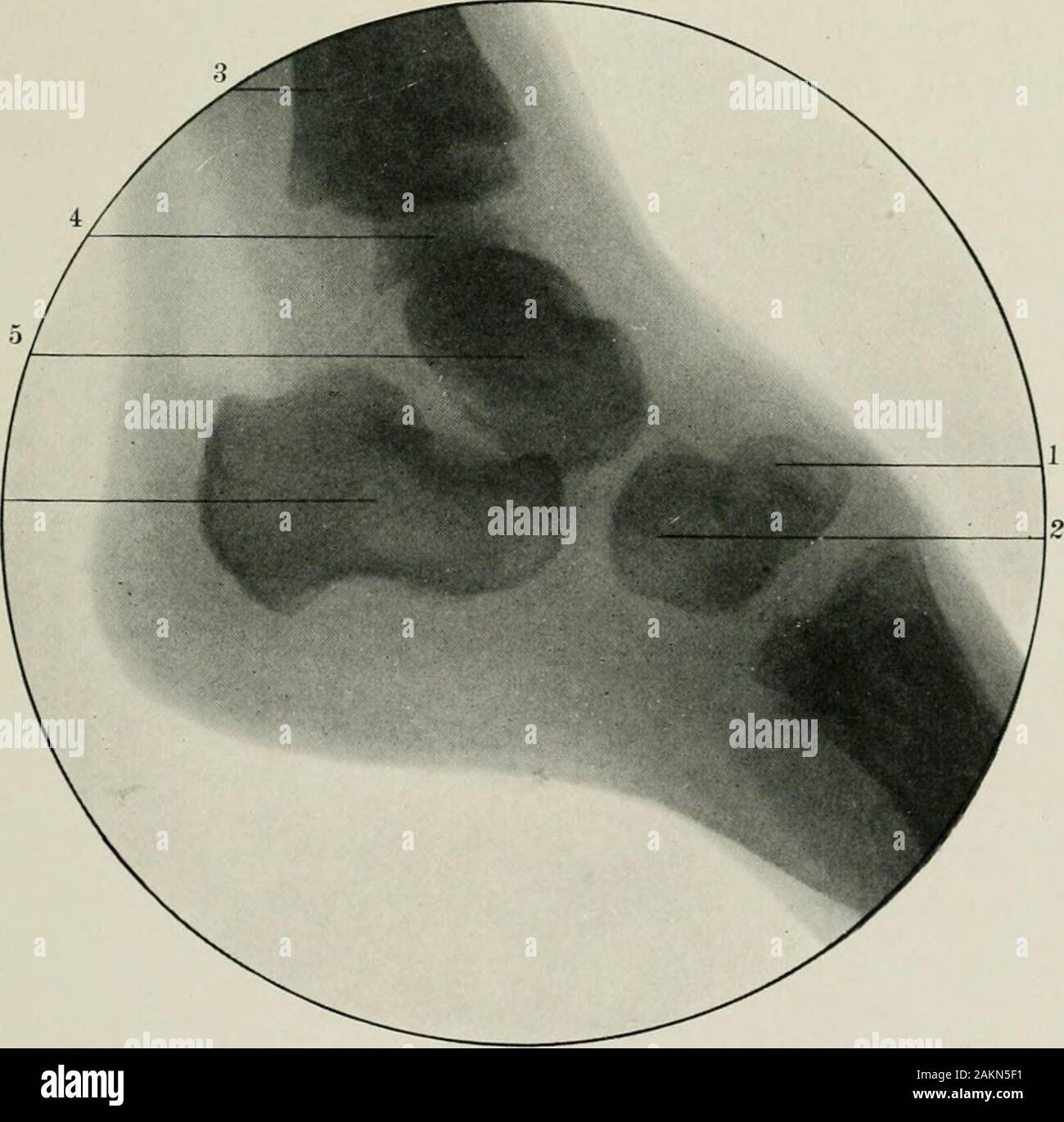 American practice of surgery : a complete system of the science and art ...